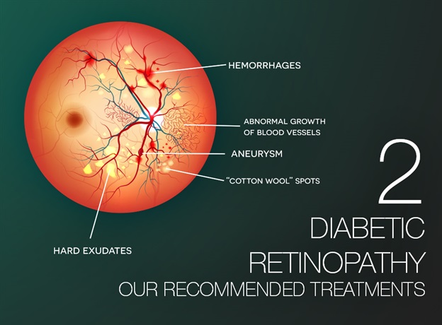Diabetic Retinopathy Part 2 Our Recommended Treatments Fairfax Va